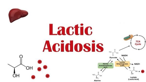 How to Reduce Lactic Acid with Supplements? - Father Fitness Blog