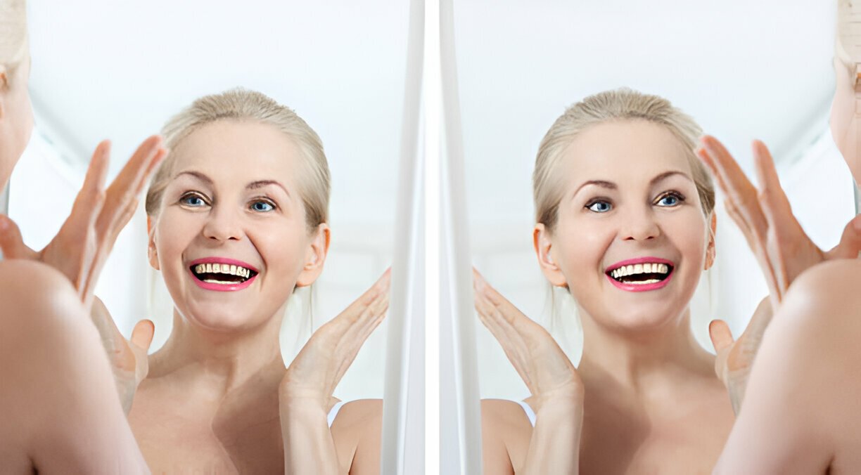 How to Get Rid of Smile Lines Top Treatments & Expert Tips in NY